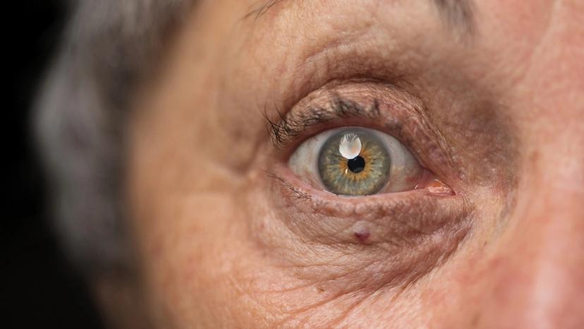New TheaLipid® Eye Drops From Théa Provide Long-lasting Symptom Relief ...